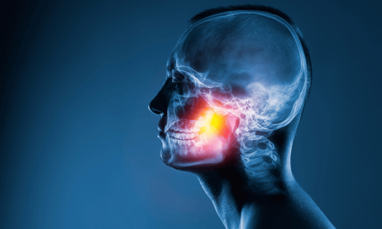 Mandible Cancer: Hope And Healing Insights Explained