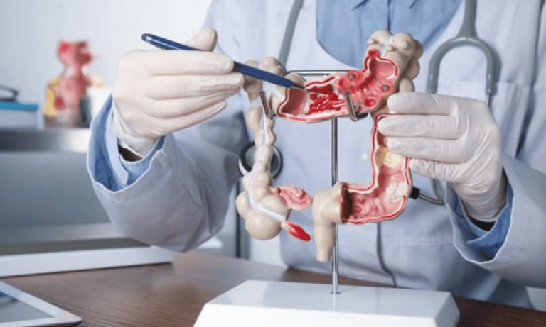 Rectal Resection - DGS Healthcare - High Quality Medical Treatments ...